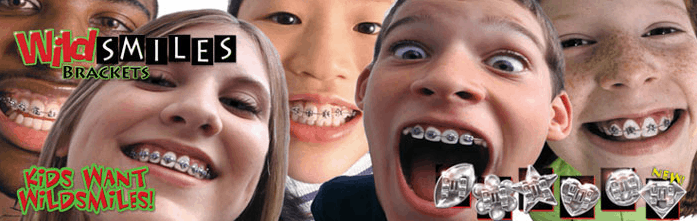 WildSmiles Braces | Manhattan Beach, CA | Dr Panucci Orthodontics