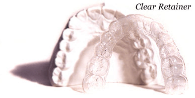 Orthodontic Retention Phase