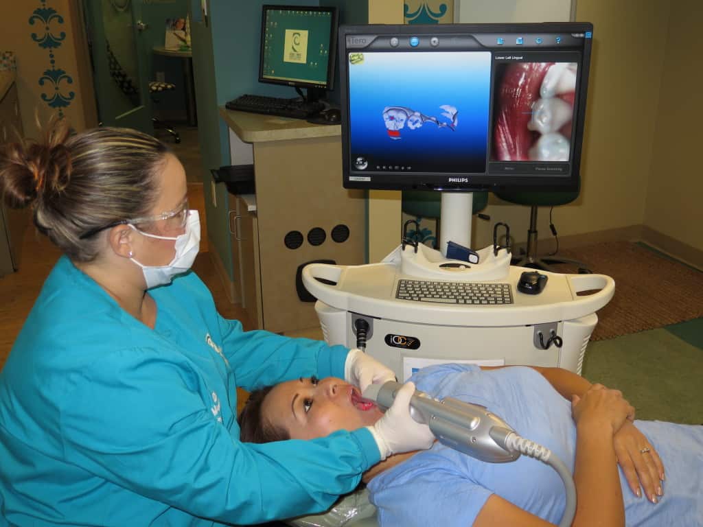 iTero Scanner - Invisalign impressions with digital iTero technology.